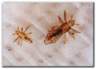Lousology 101 – Understand louse and nits | HeadLice.Org